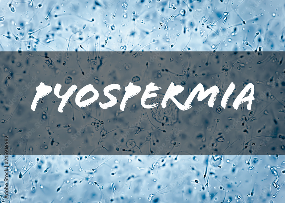 Pyospermia medical term, a high number of white blood cells or puus ...