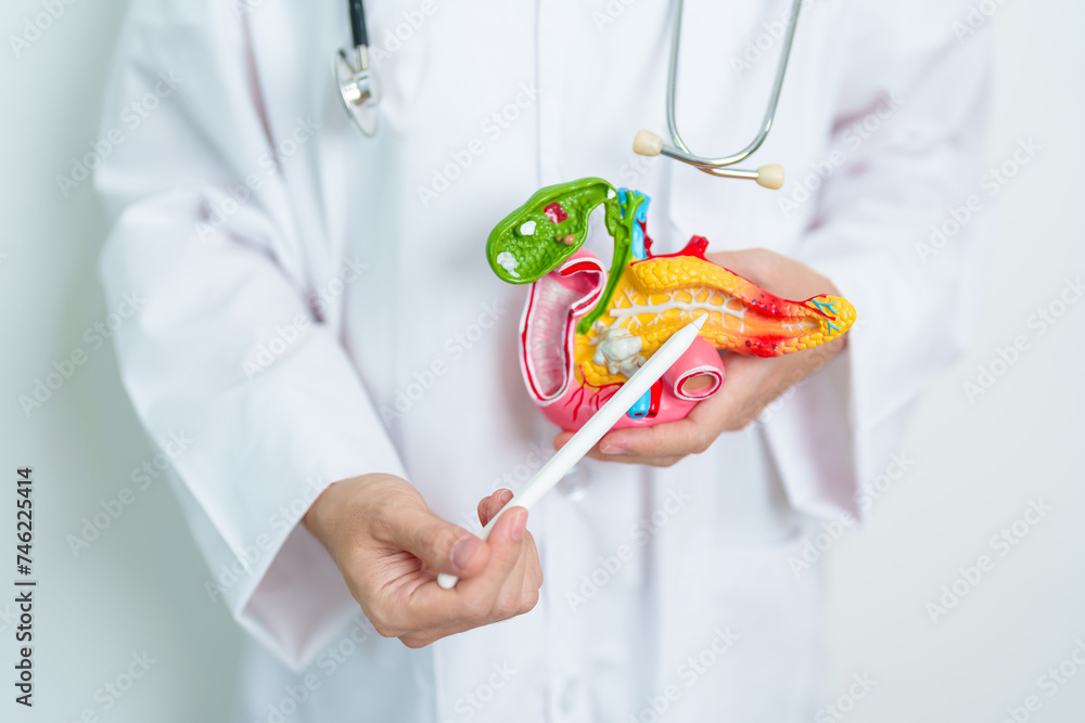 Doctor with human Pancreatitis anatomy model with Pancreas, Gallbladder ...