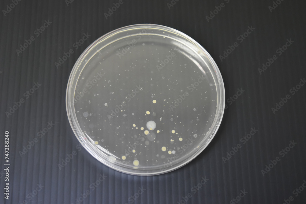 Colonies of bacteria growth on agar plate medium in laboratory. Stock ...