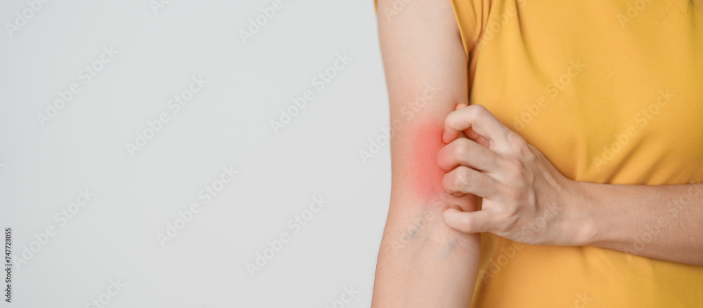 woman itching and scratching itchy arm. Sensitive Skin Allergic ...