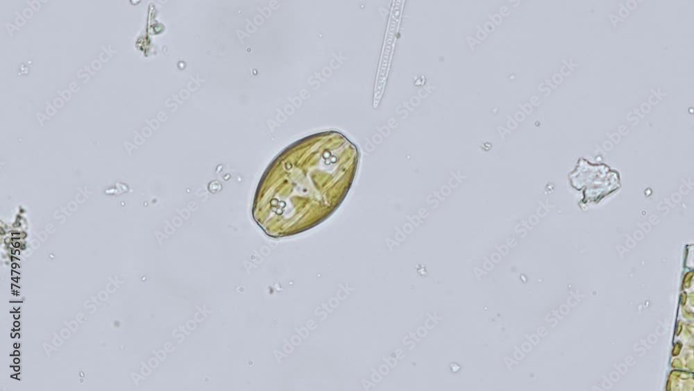 freshwater diatom algae under the microscope - optical microscope x400 ...
