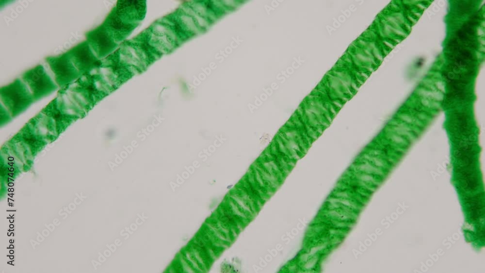 Spirogyra Under Microscope Labeled