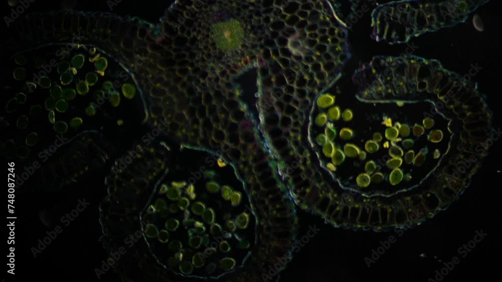 Stamen or Anther under microscope. Cross section of a Lilium stamen ...