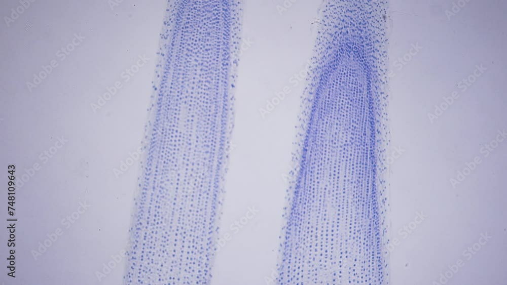 Root under microscope, 100x magnification Organ of plant that are ...