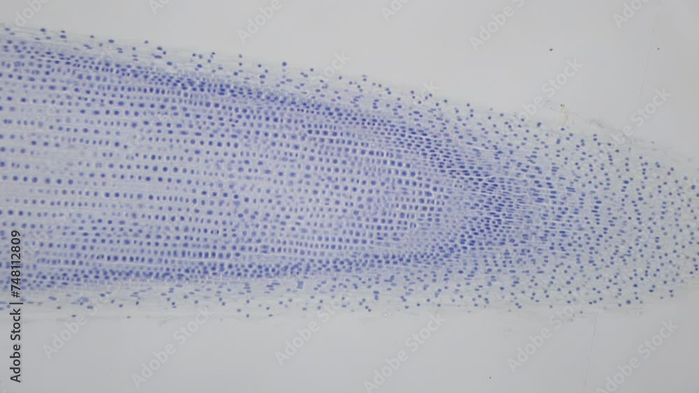 Intensive growth zone of plant. Onion root under microscope ...