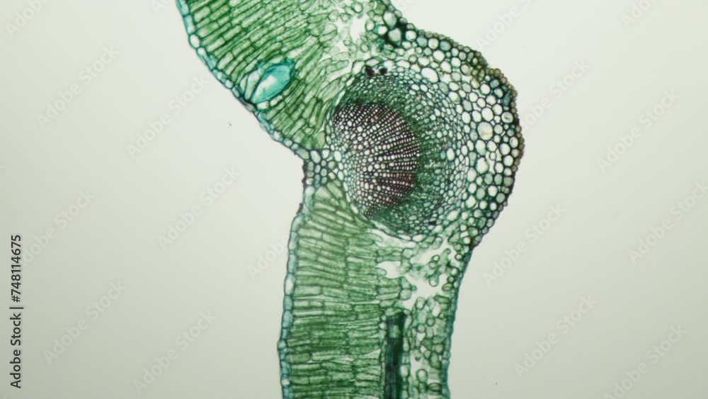 Microbotany. Cross section of green leaf under microscope, 100x ...