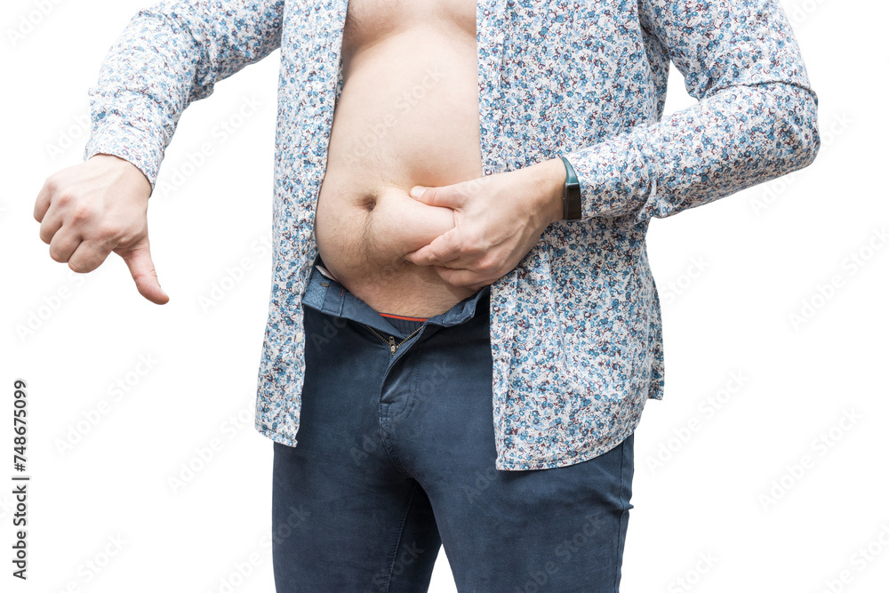 Overweight man in unbuttoned tight trousers holding his fat belly and ...