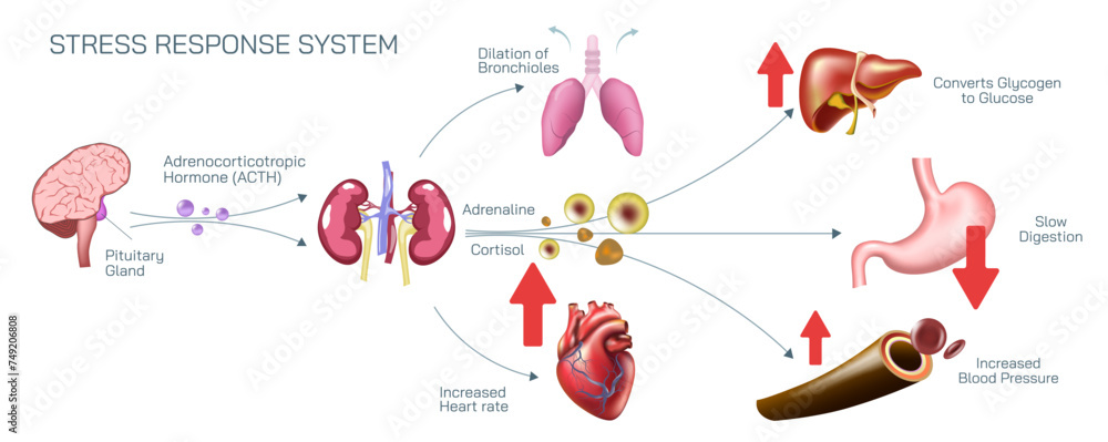 What is Stress response system vector illustration. A stressful ...