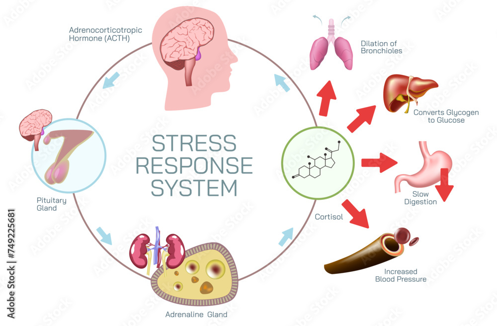 What is Stress response system vector illustration. A stressful ...