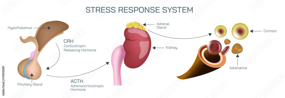 What is Stress response system vector illustration. A stressful ...