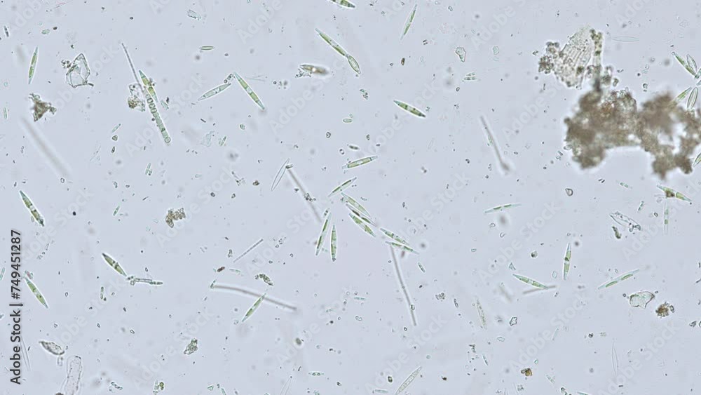 freshwater diatom algae from a river under the microscope - optical ...