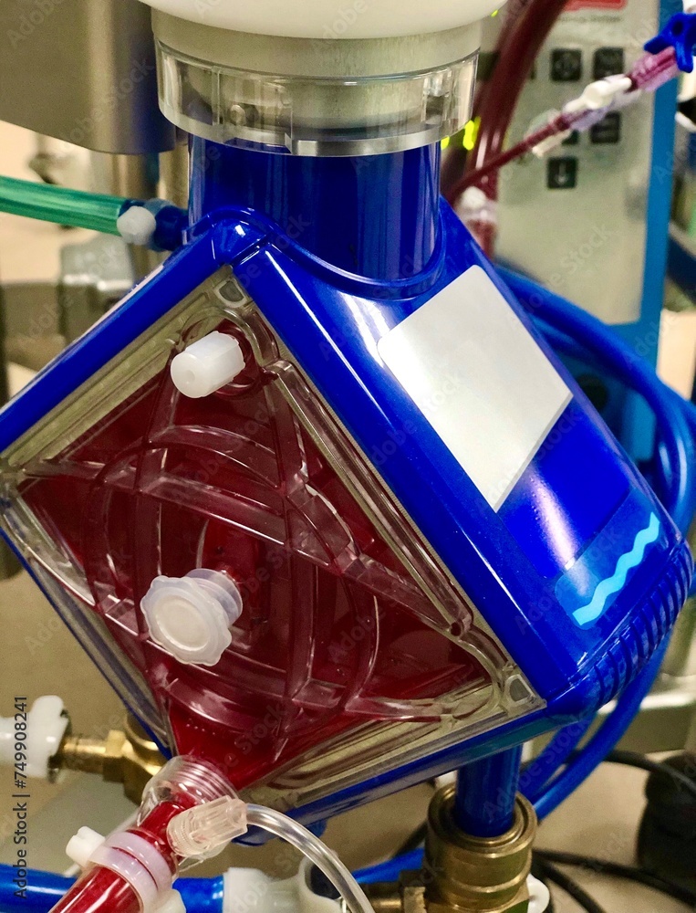 ECMO (Extracorporeal membrane oxygenation) in critical care unit (CCU ...