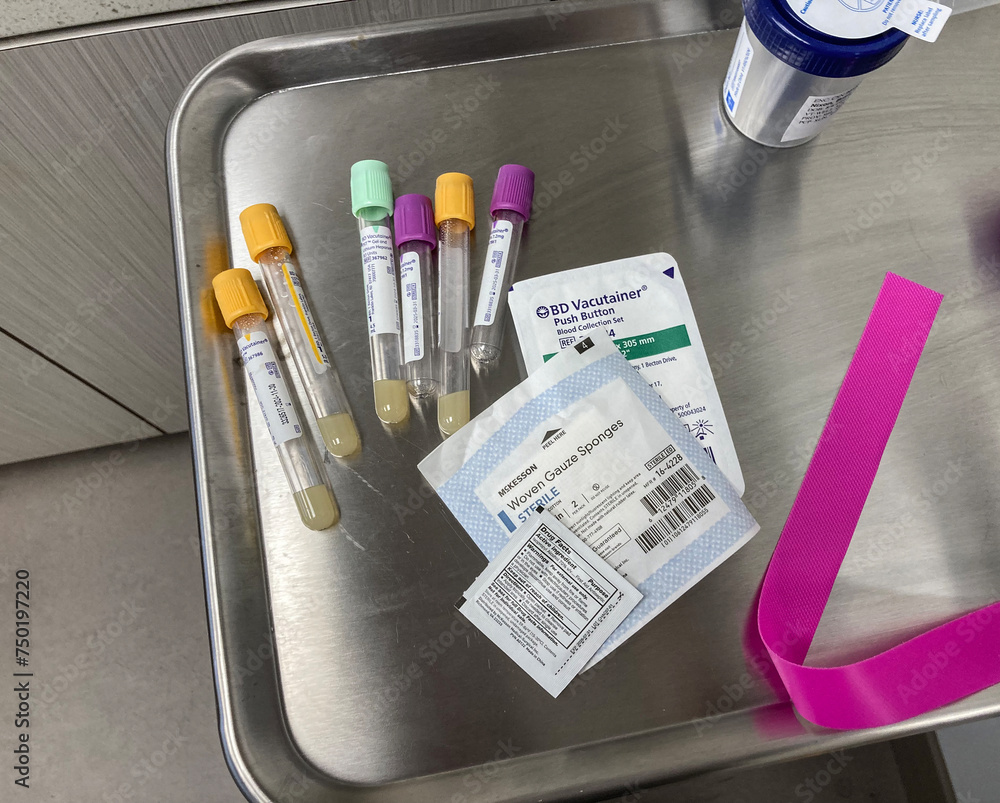 Los Angeles, California USA - February 27, 2024: Blood vials, urine ...