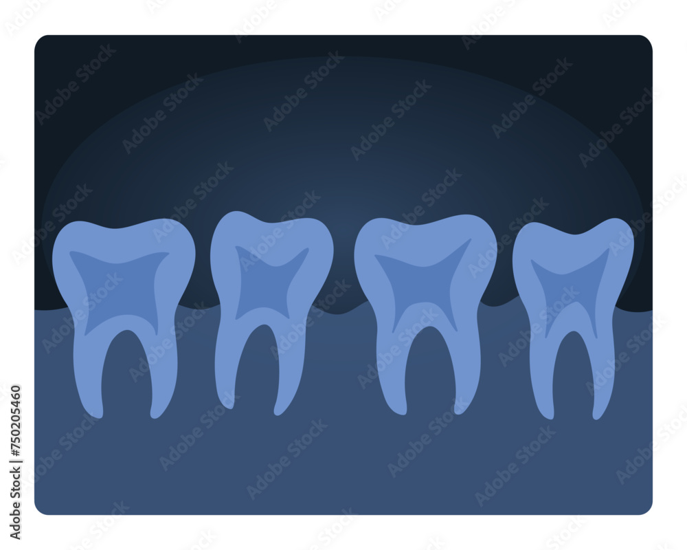 Dental xray scan. Human teeth radiography, medical test of human tooth ...