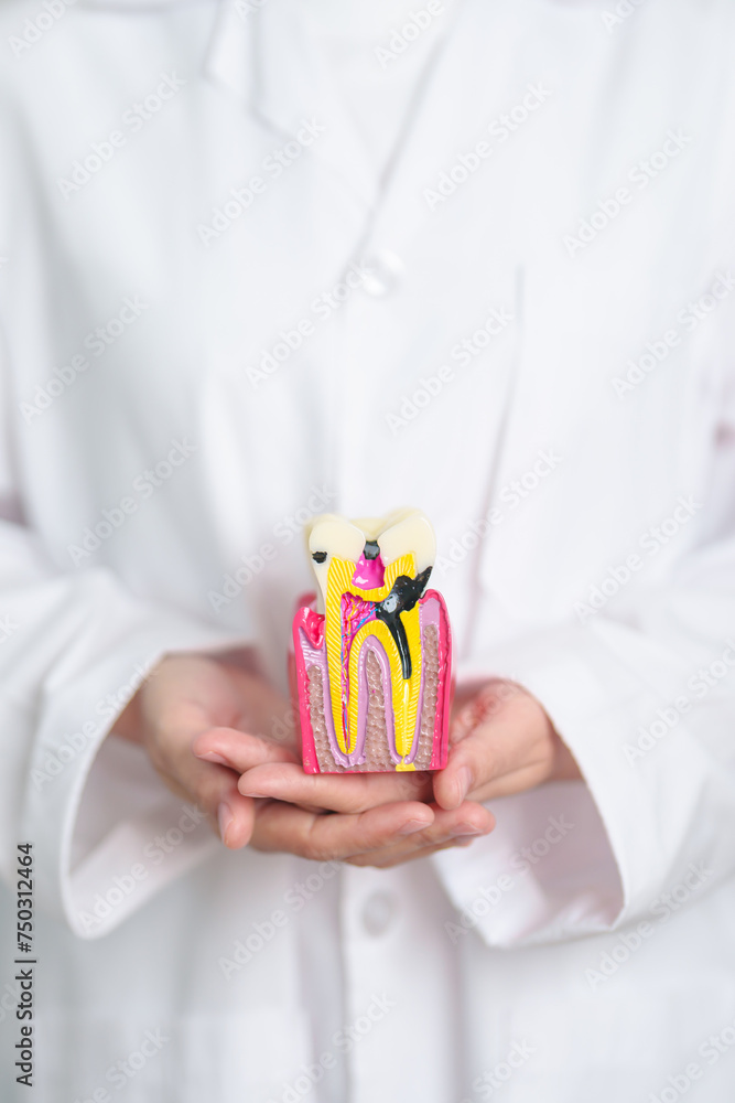 Dentist with tooth Anatomy model. Oral Teeth decay and disease, Scrape ...
