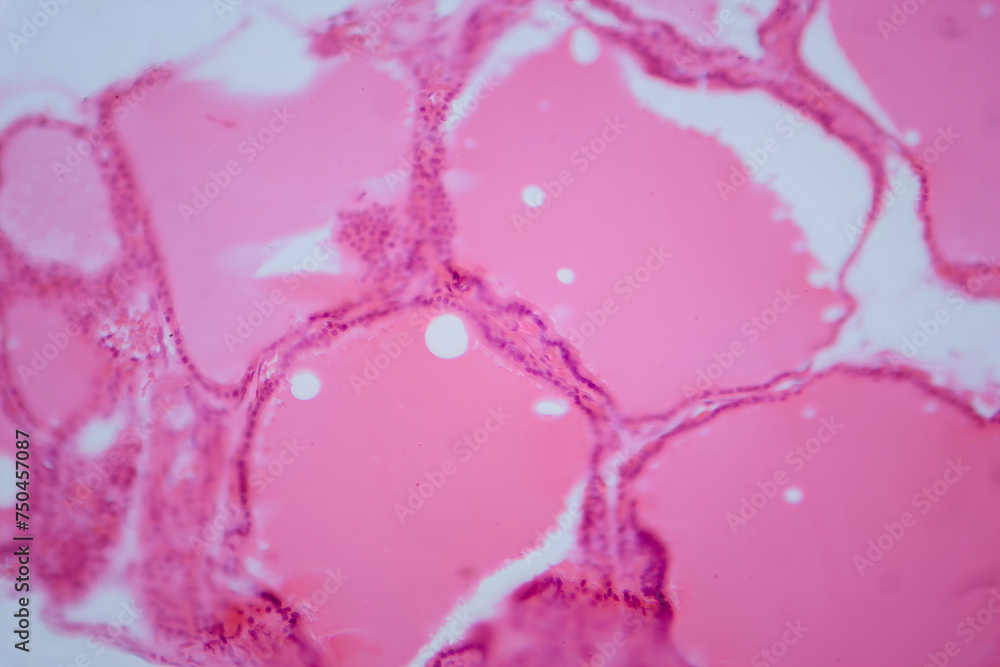 Poster Thyroid gland under a microscope, light micrograph exhibiting ...