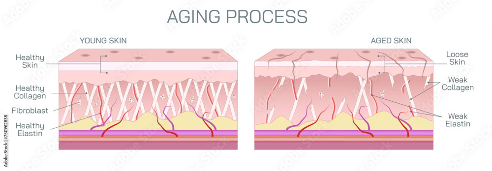 Aging process of skin. Aging skin looks thinner, paler, and clear or ...