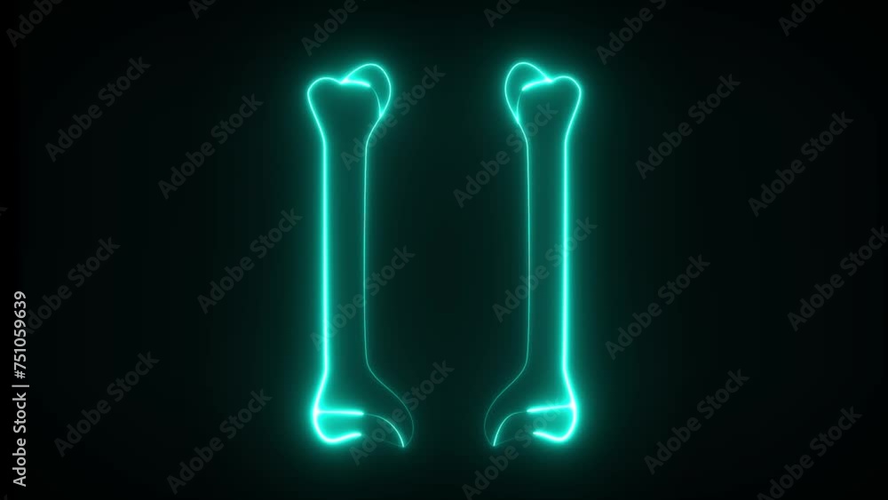 These are femur and parts of lower extremity. Femur is the longest bone ...