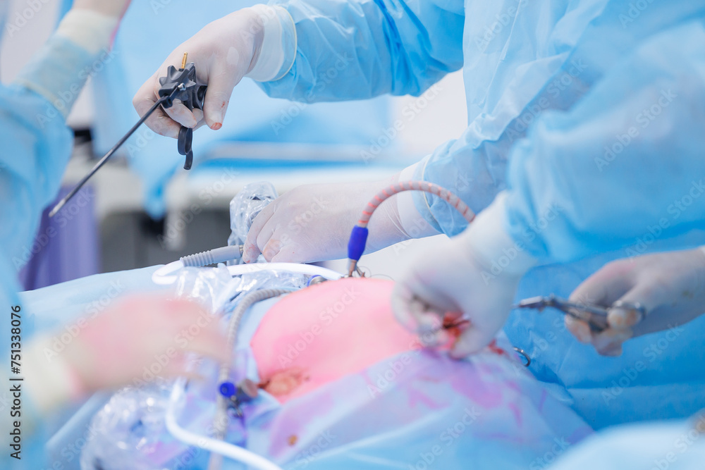 Minimally invasive surgery, team doctors use medical equipment ...