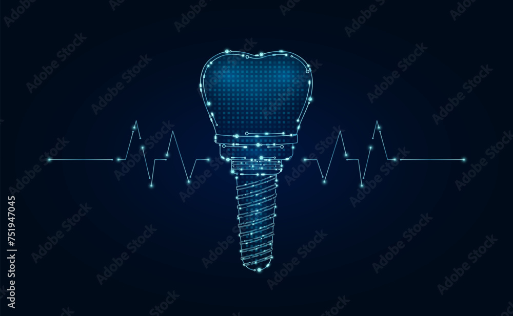 Electronic dental implant and pulse wave glowing between connecting ...
