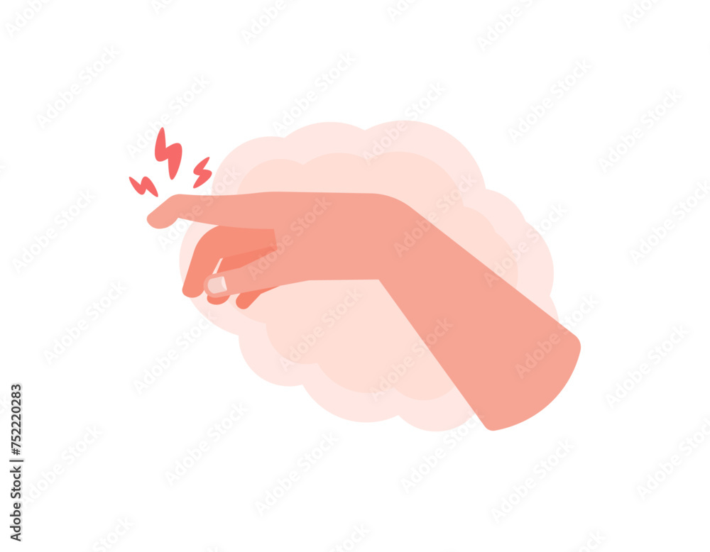 Mallet Fingers. Illustration of a hand with the tip of the index finger ...