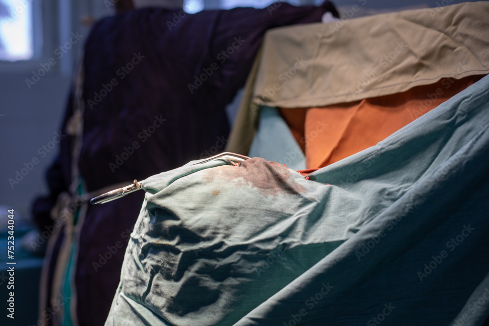 neurosurgeon , doing surgery, operation theater, subdural hematoma in ...