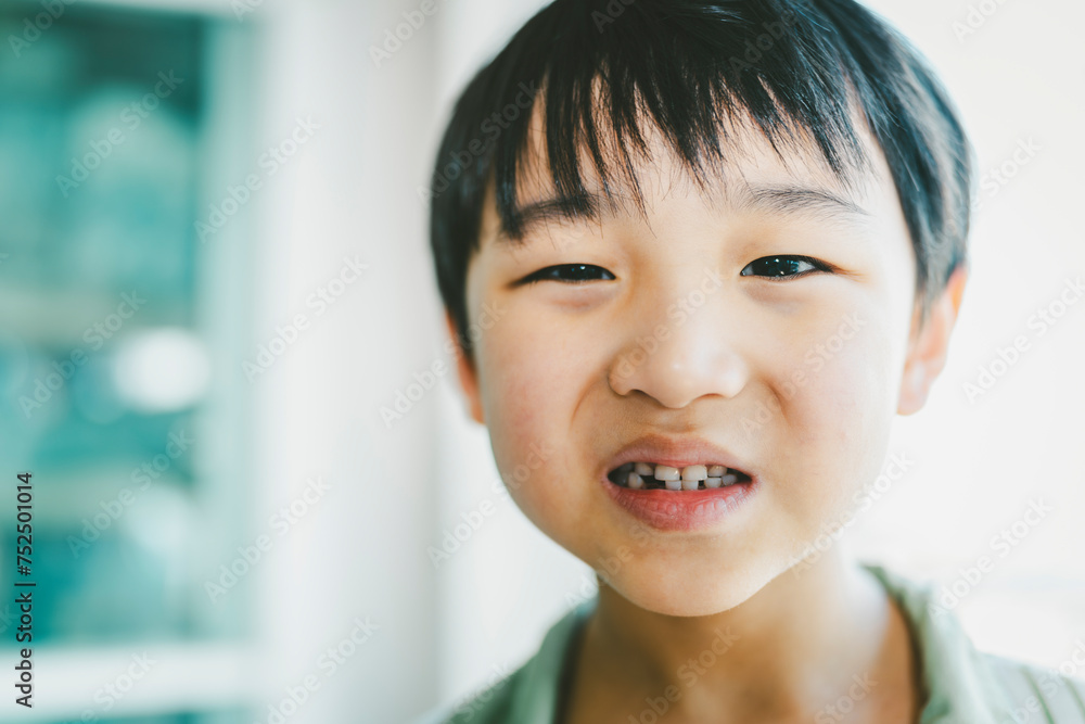 Asian boy smiles showing recently fallen teeth, oral health concept ...
