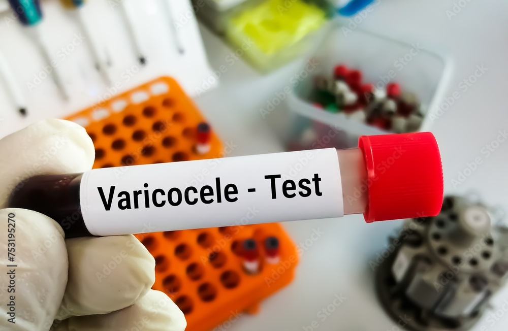 Varicocele, is the enlargement of the veins that transport oxygen ...
