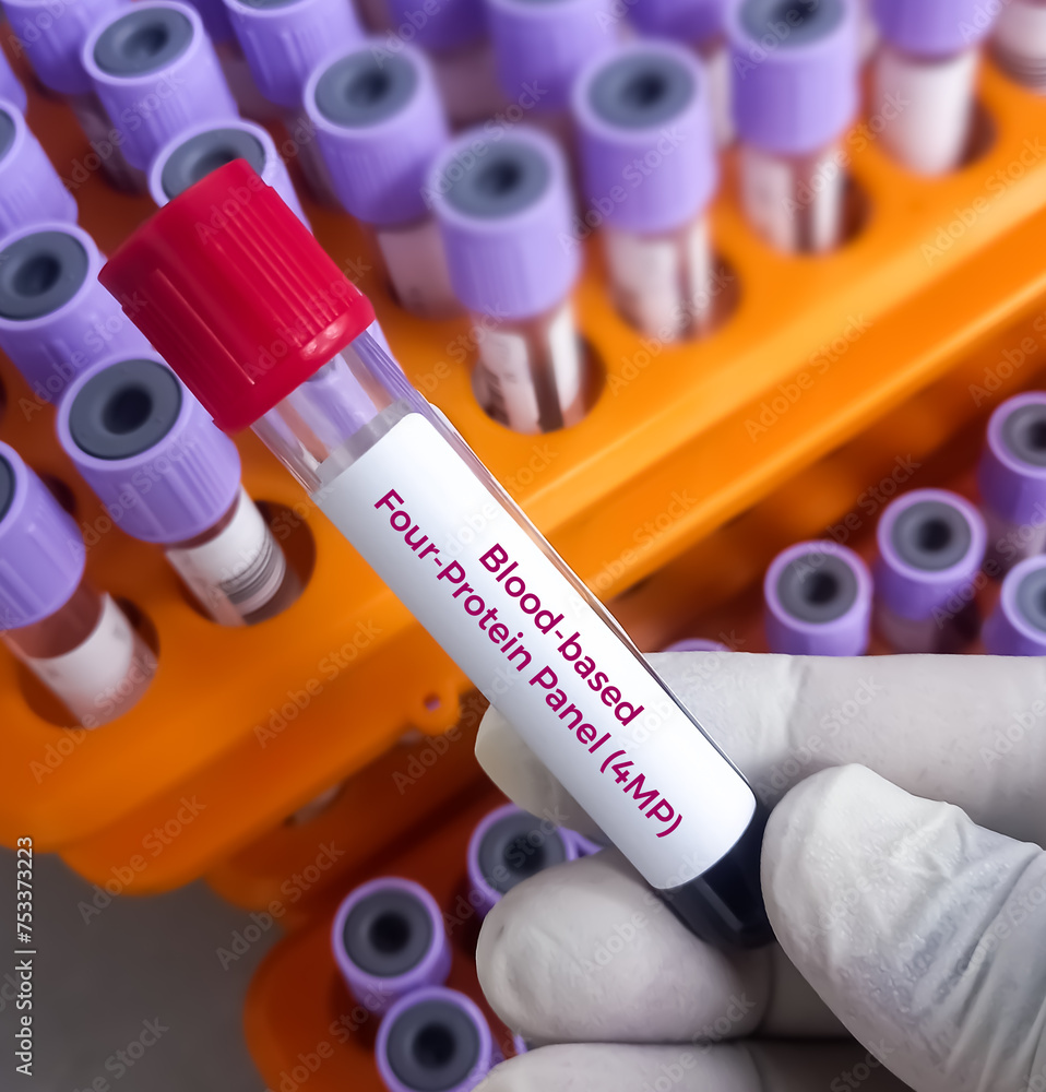 Blood sample for blood-based four-marker protein (4MP) panel, can help ...