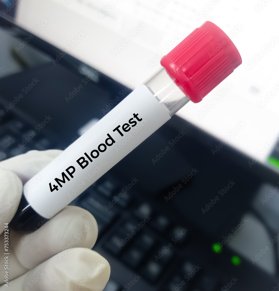Blood sample for blood-based four-marker protein (4MP) panel, can help ...