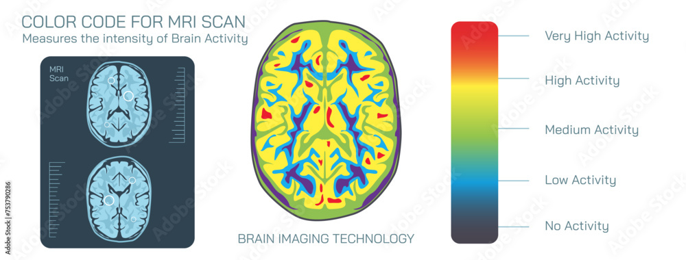 Brain MRI scan vector illustration. Magnetic resonance imaging is a ...