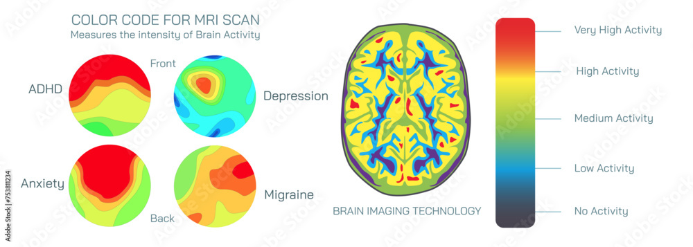 Brain MRI scan vector illustration. Magnetic resonance imaging is a ...