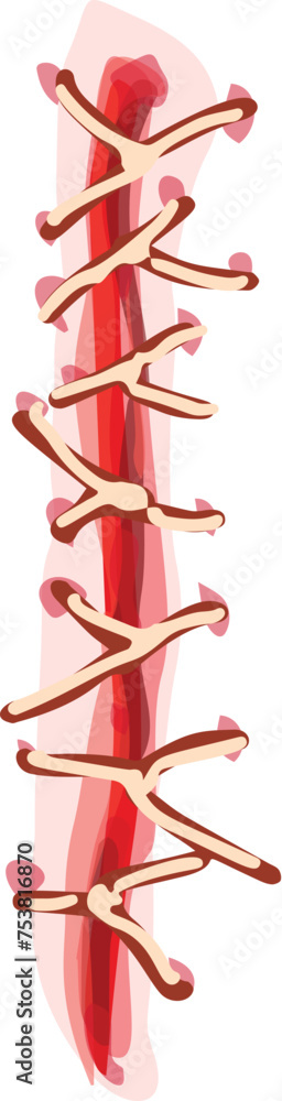 Wound suture icon cartoon vector. Tool equipment. Seam metal care aid ...