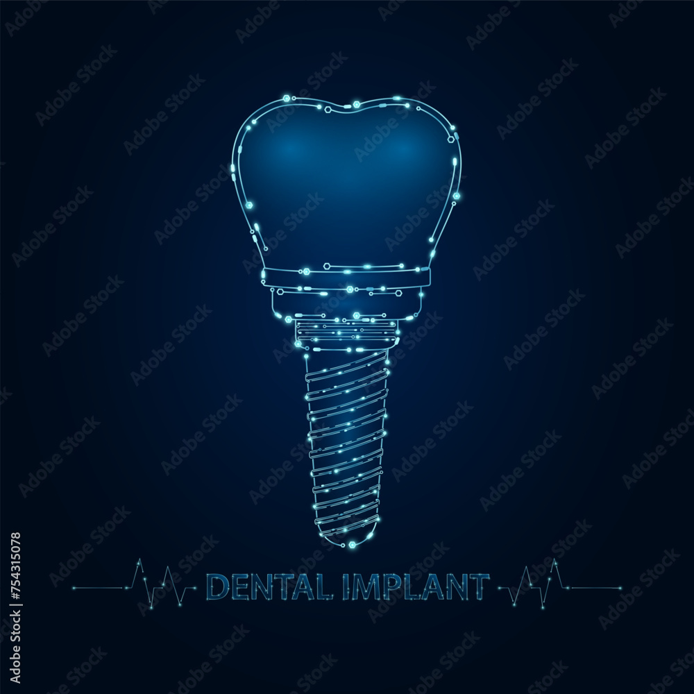Dental implant in electronic form glowing between information ...