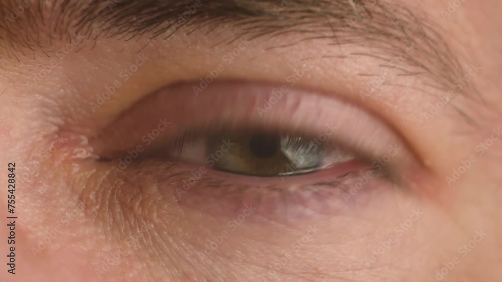 Man crying, red inflamed eye with tears close-up. Male with vision ...