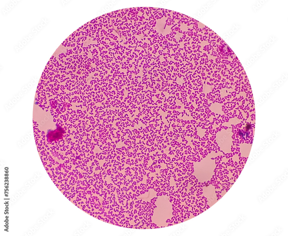 Salmonellosis. Microscopic view of gram stained slide from blood agar ...