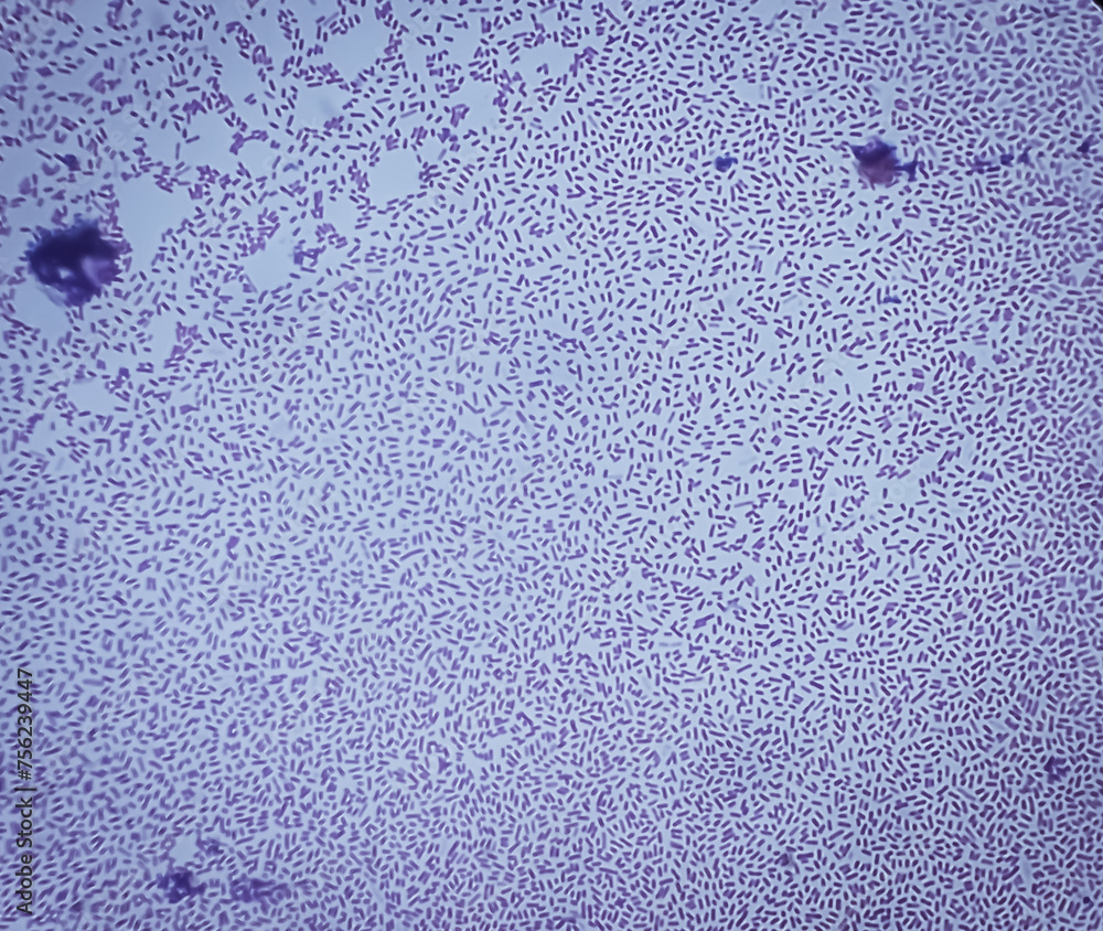 Salmonellosis. Microscopic view of gram stained slide from blood agar ...