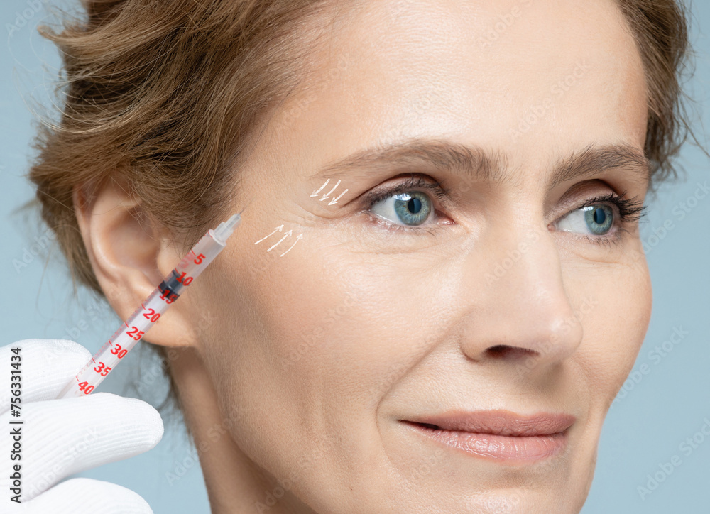 Biorevitalization procedure. Middle-aged woman while beauty injections ...