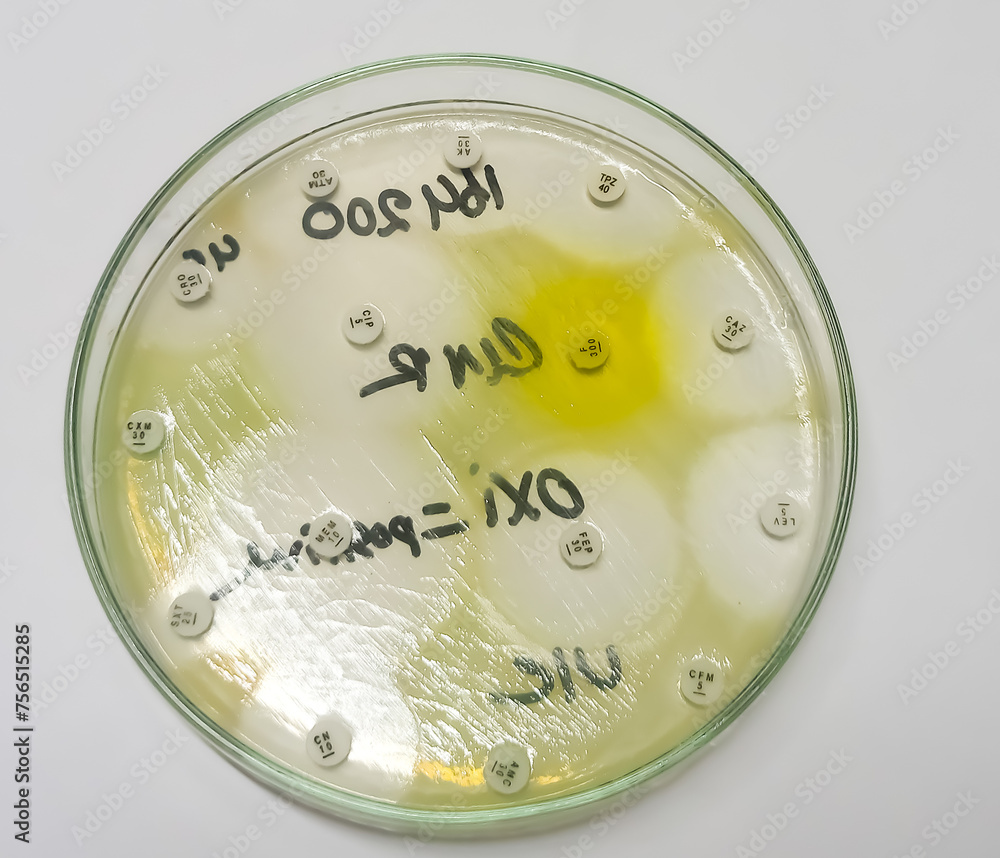 Antimicrobial susceptibility testing, Pseudomonas aeruginosa in culture ...