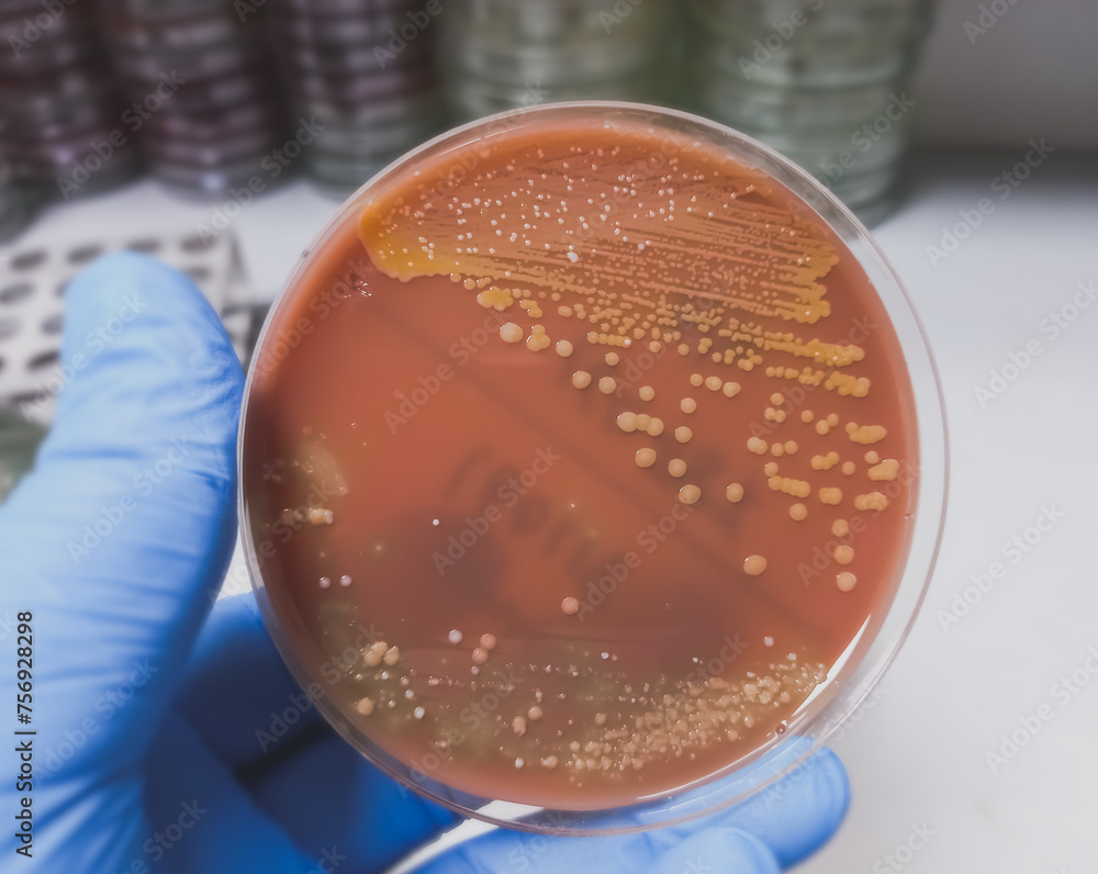 Golden color colonies on chocolate agar medium, growth of ...