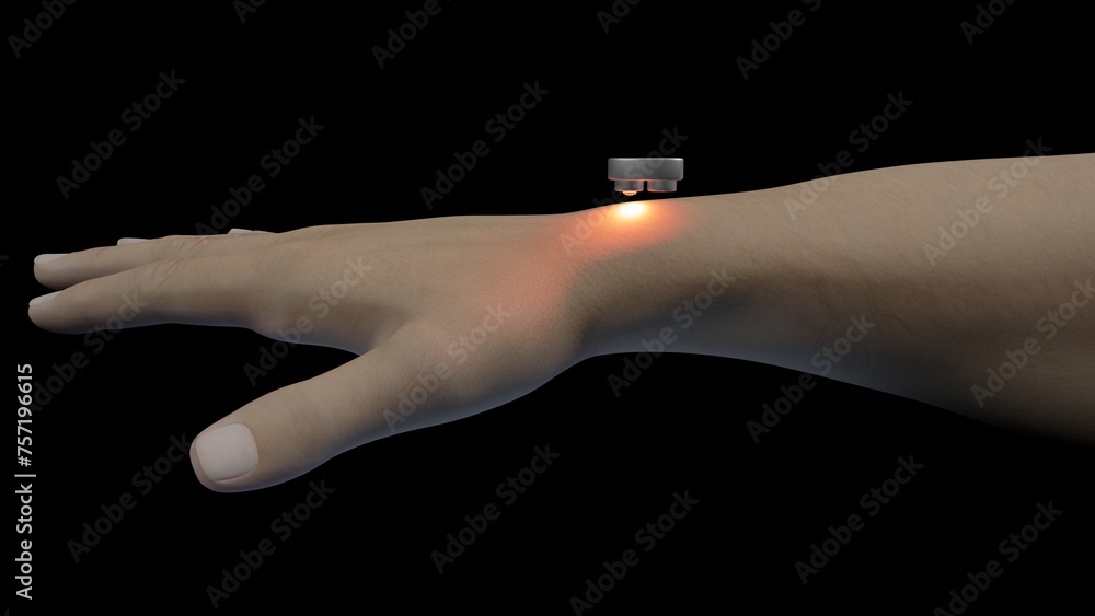 Photoplethysmography optoelectronic sensor. PPG detecting blood flow ...