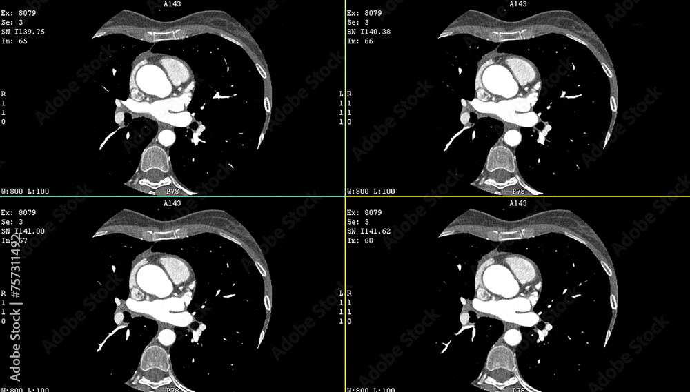 Axial contrast of the cardio system with radiology. A computerized ...