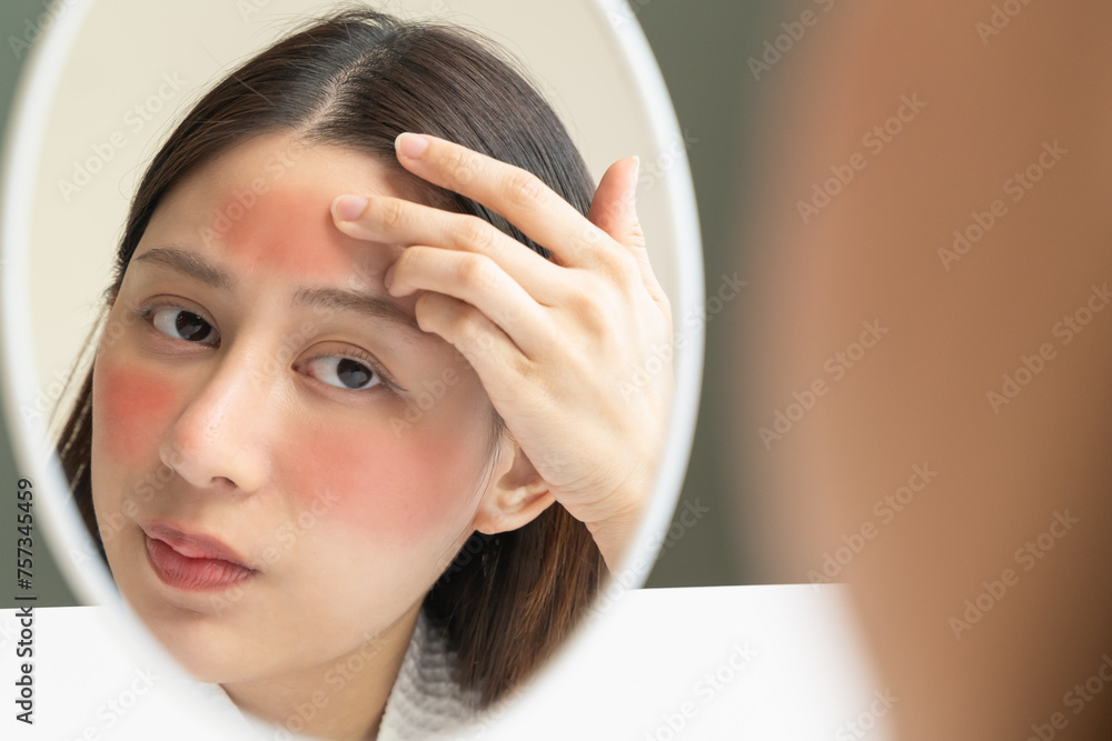 Asian young woman looking face skin in the mirror have a red rash on ...