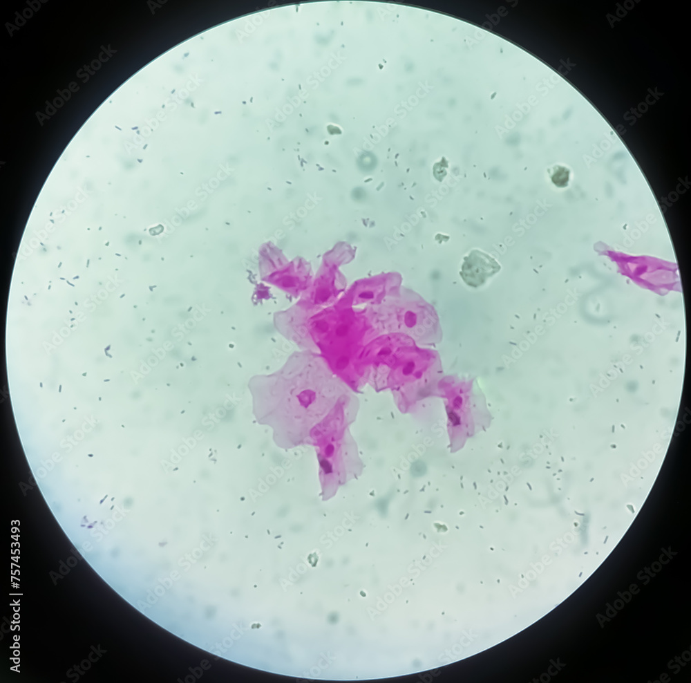 Microscopic close view of high vaginal swab Gram stain smear, 40x ...
