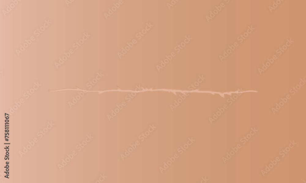 Healing wounds, skin scar, stitched gash and cut. Realistic surgical ...