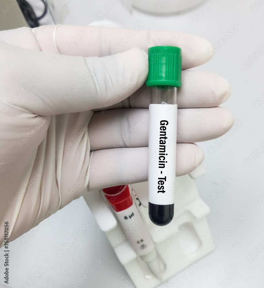 Blood sample for Gentamicin level test, drug therapy and monitor ...