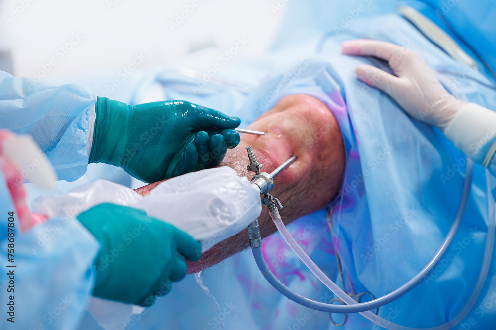 Suturing tendons and ligaments in knee of man, operating hospital ...