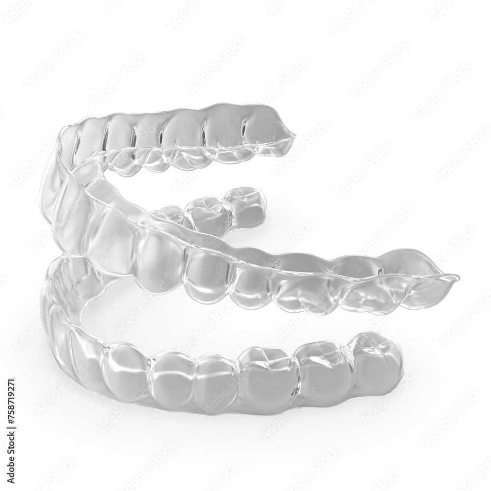 Teeth Replacement Retainer with Clear Aligners - Advanced Solution for ...