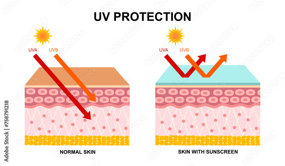 UV Protection. The difference between skin without sunscreen lotion and ...