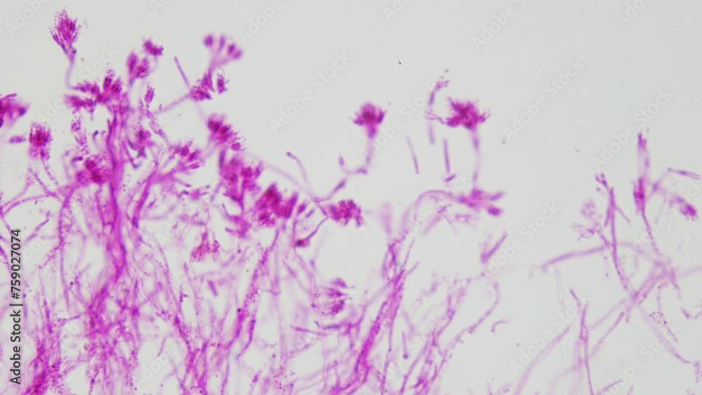 Penicillium. Producers of the antibiotic penicillin under microscope ...